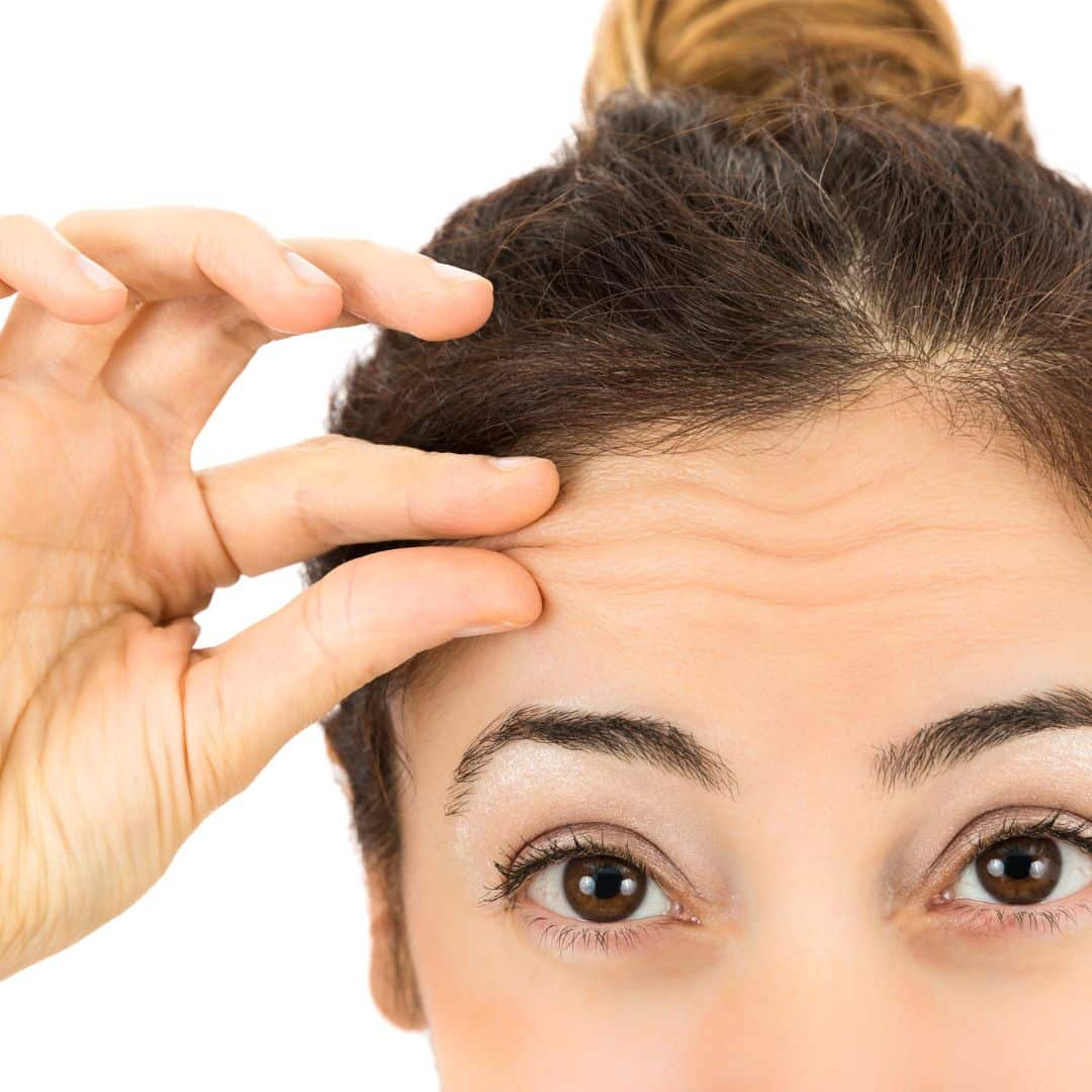 Anatomy of a Wrinkle - Therapeutic Aesthetics